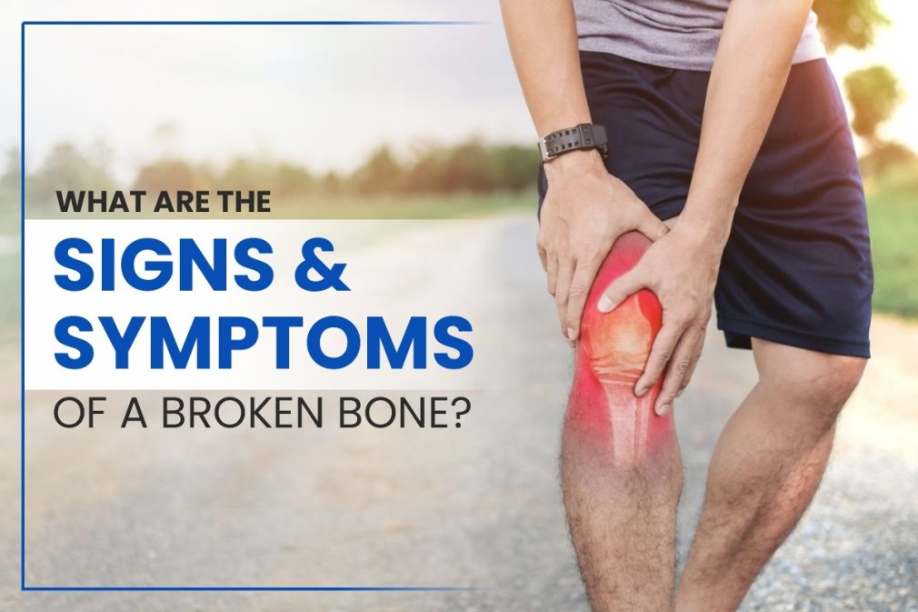 What are the signs and symptoms of a broken bone?