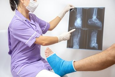 What are the signs and symptoms of a broken bone?
