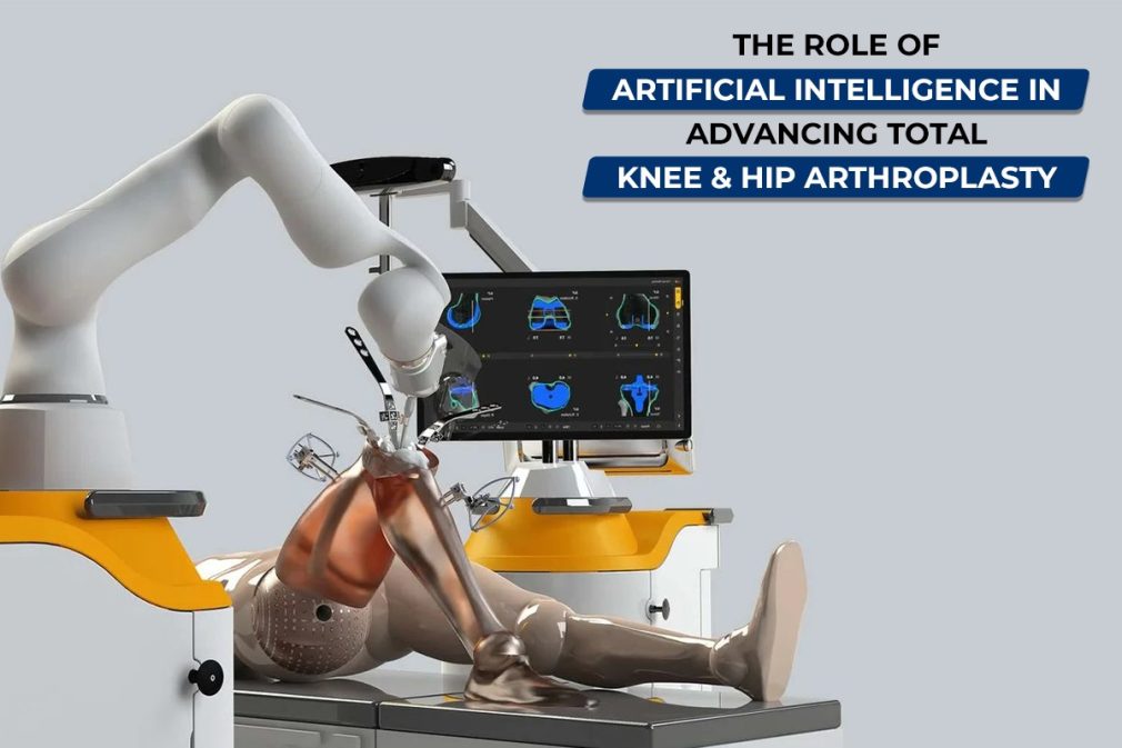 The Role of Artificial Intelligence in Advancing Total Knee & Hip ...